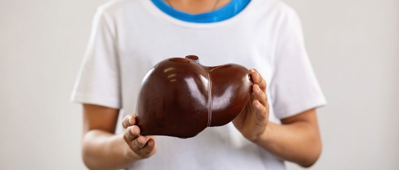 کبد چرب چیست؟ آیا چربی خون همان چربی کبد است؟ علائم و درمان
